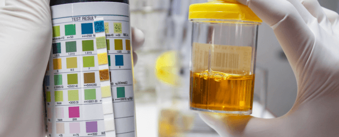 Will Drinking Water Reduce Protein in Urine?